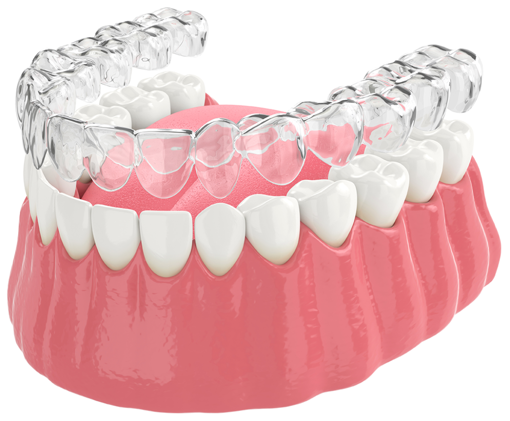 We are a Certified Invisalign Provider - Chestnut Ridge Dental